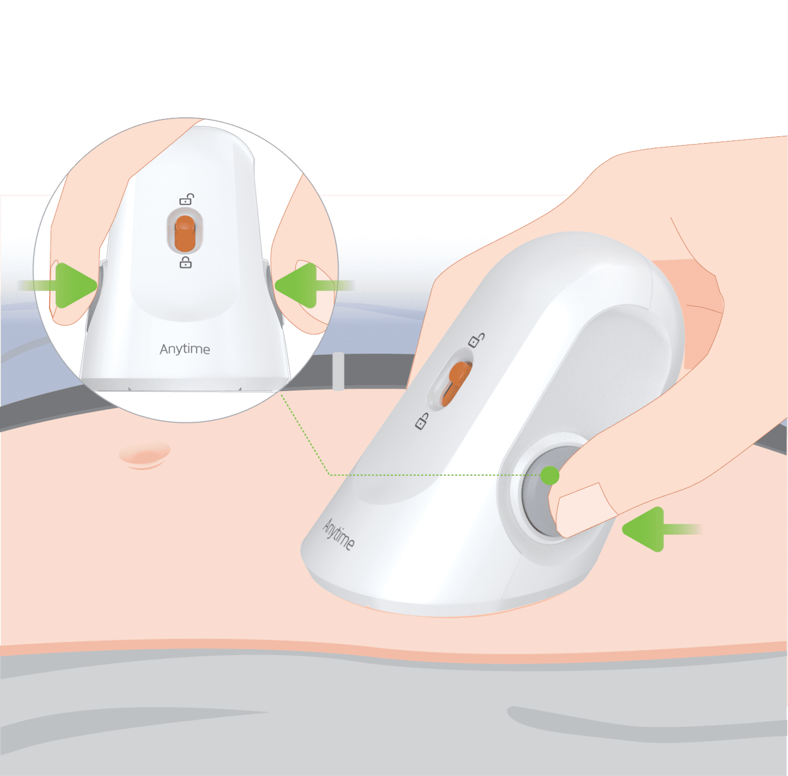 Yuwell Anytime CT-3: Advanced Glucose Monitoring System