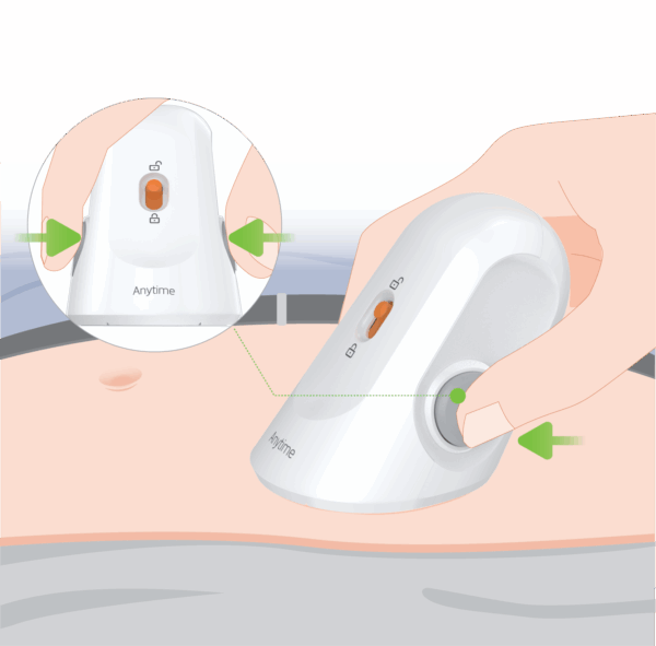 Yuwell Anytime CT-3: Advanced Glucose Monitoring System